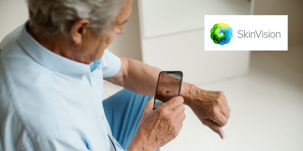 SkinVision Earns Europe’s Top Medical Certification for AI-Powered Skin ...